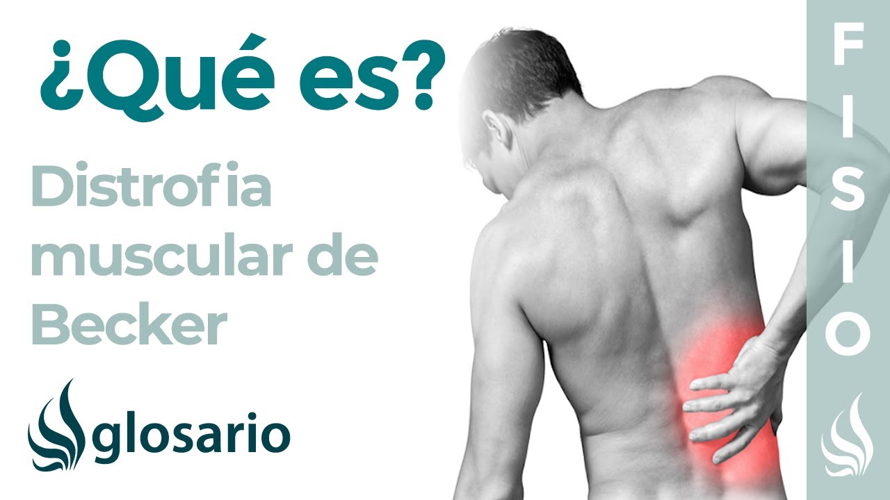 Atrofia muscular que es causas sintomas y tratamiento - Terapeutas ...